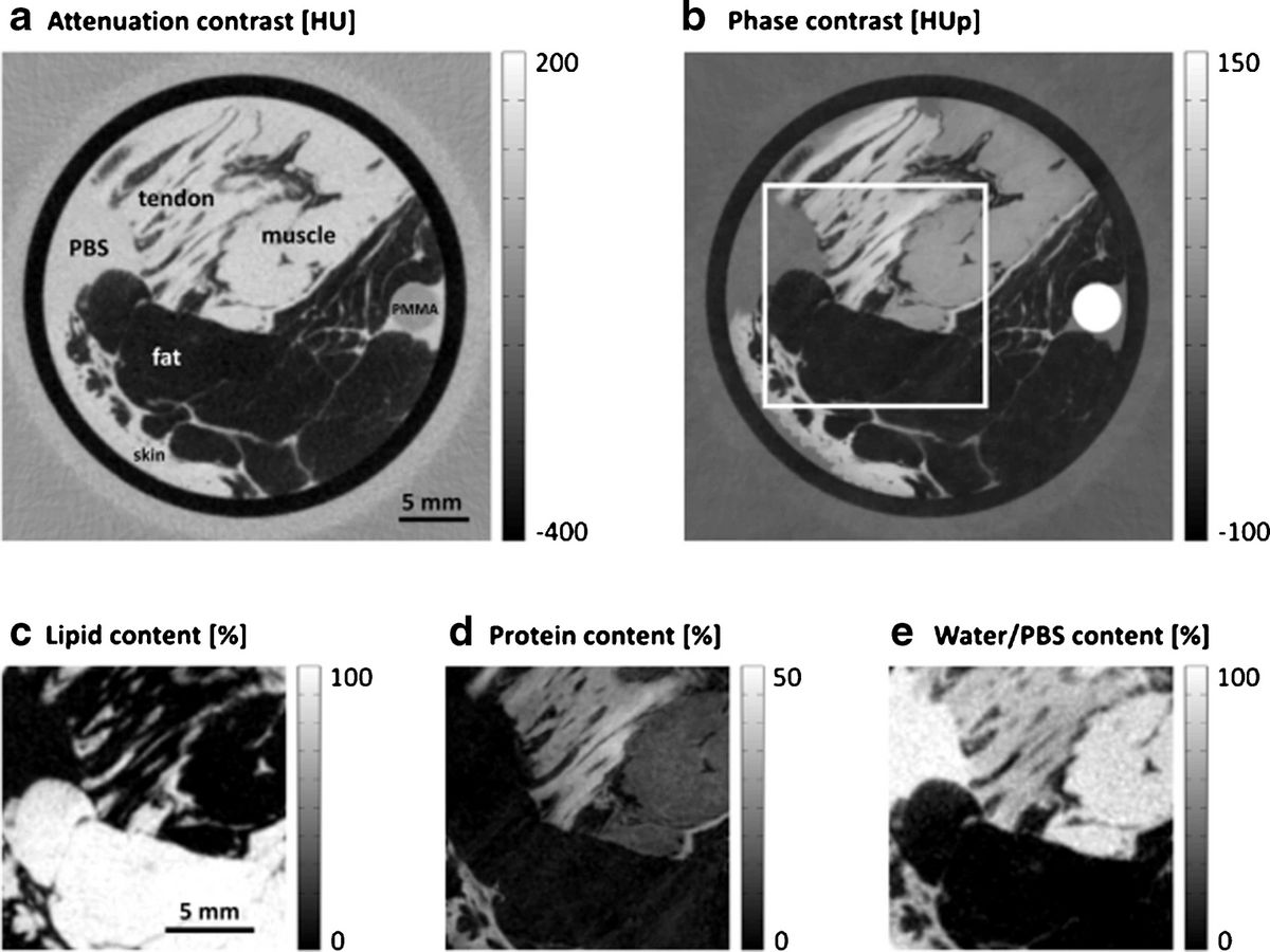 Quantitative X Ray Phase Contrast Computed Tomography With Grating Interferometry Biomedical