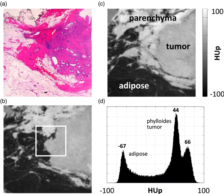 Quantitative breast tissue characterization using grating-based x-ray ...