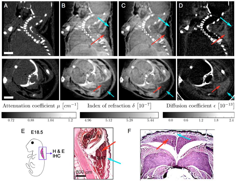 X-ray phase-contrast tomography with a compact laser-driven synchrotron ...