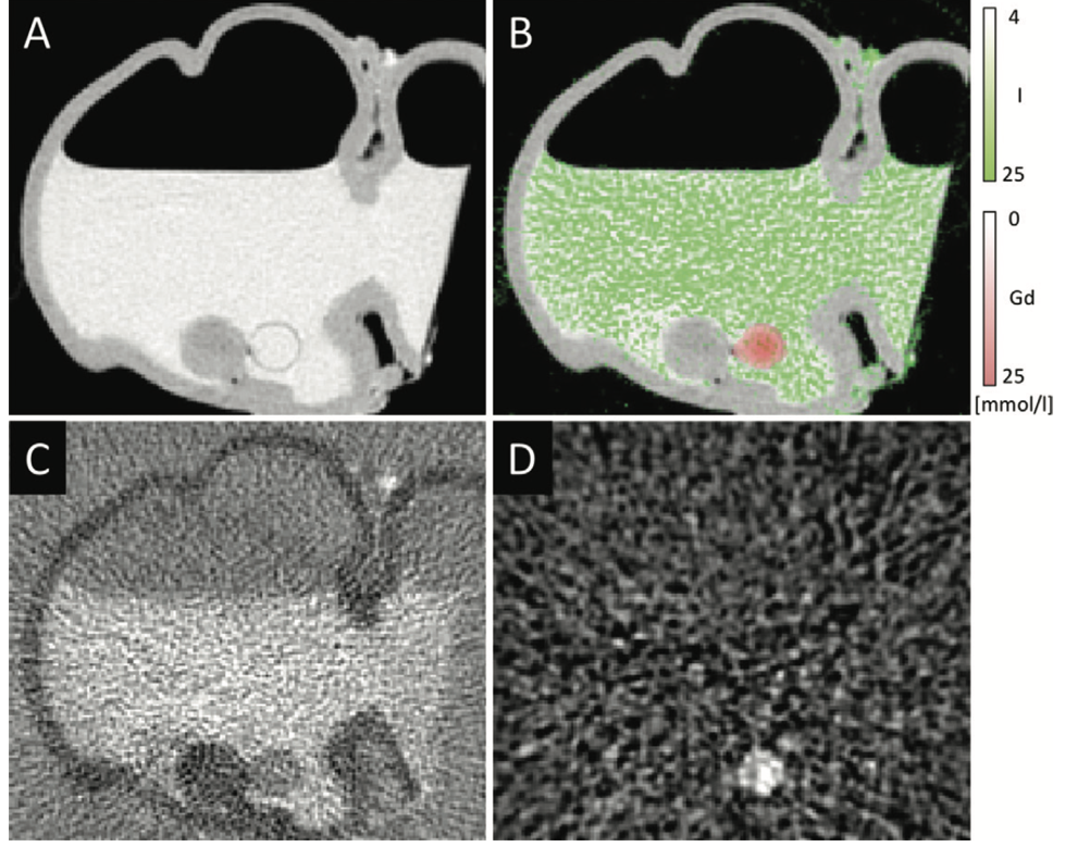 Spectral Photon Counting Ct Initial Experience With Dual Contrast Agent K Edge Colonography