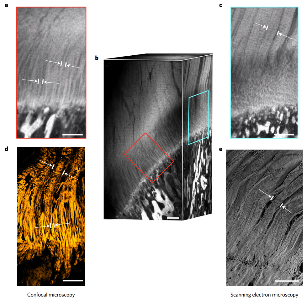 The microstructure and micromechanics of the tendon-bone insertion ...