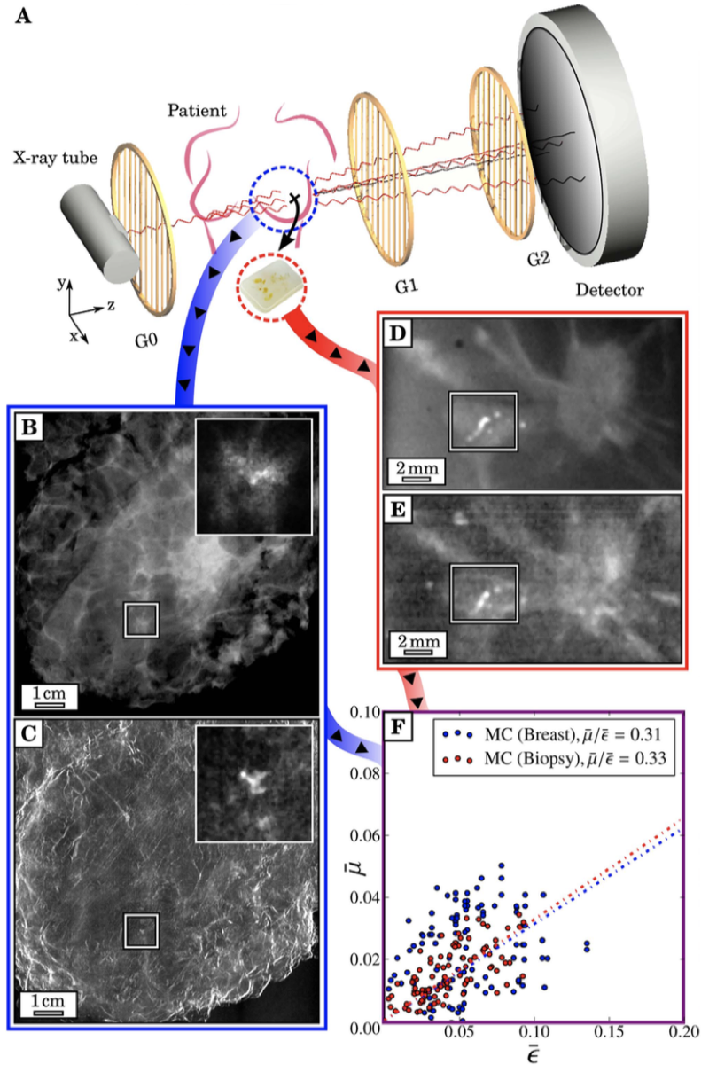 Improved Diagnostics by Assessing the Micromorphology of Breast ...